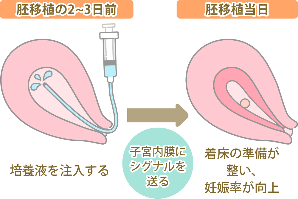 SEET法後の過ごし方とは？妊娠率を高める先進医療を詳しく解説 | にしたんARTクリニック
